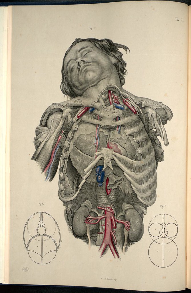 Dissection and Cadaver Theft in American Medical Education – Skeletons ...